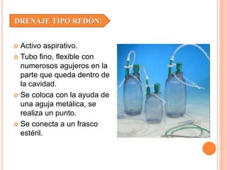 Drenajes Cirugía | PPTX