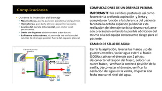 Drenajes Pleurales UNIV. Royer Gerson Paniagua Miranda.pptx