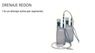 DRENAJES QUIRÚRGICOS.pptx