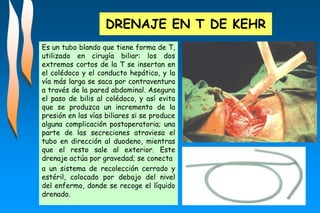 drenajesquirurgicos-161227061415.pdf