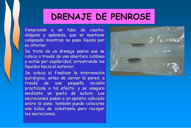 DRENAJE QUIRURGICO