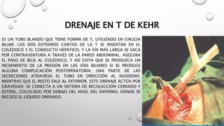 DRENAJES QUIRURGICOS, ENFERMERIA MEDICO QUIRURGICA | PPTX