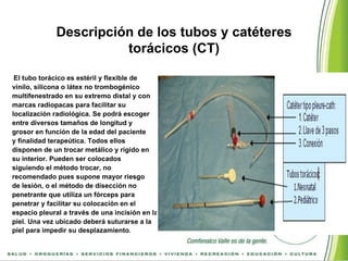 Drenajes toracicos equipos | PPT