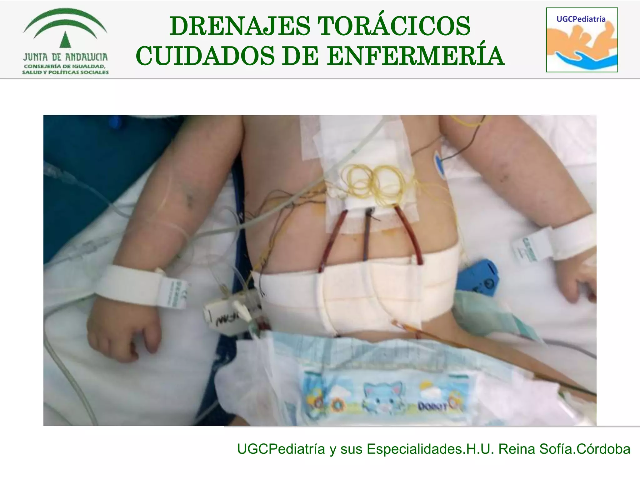 Drenajes torácicos en pediatría. Cuidados de enfermería. | PPT