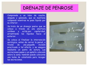 Drenaje y Sondas Quirúrgicas, técnicas y utilización | PPTX
