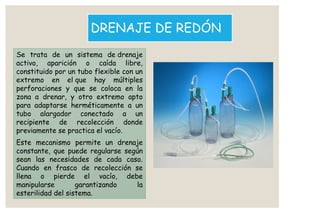 Drenaje y Sondas Quirúrgicas, técnicas y utilización | PPTX