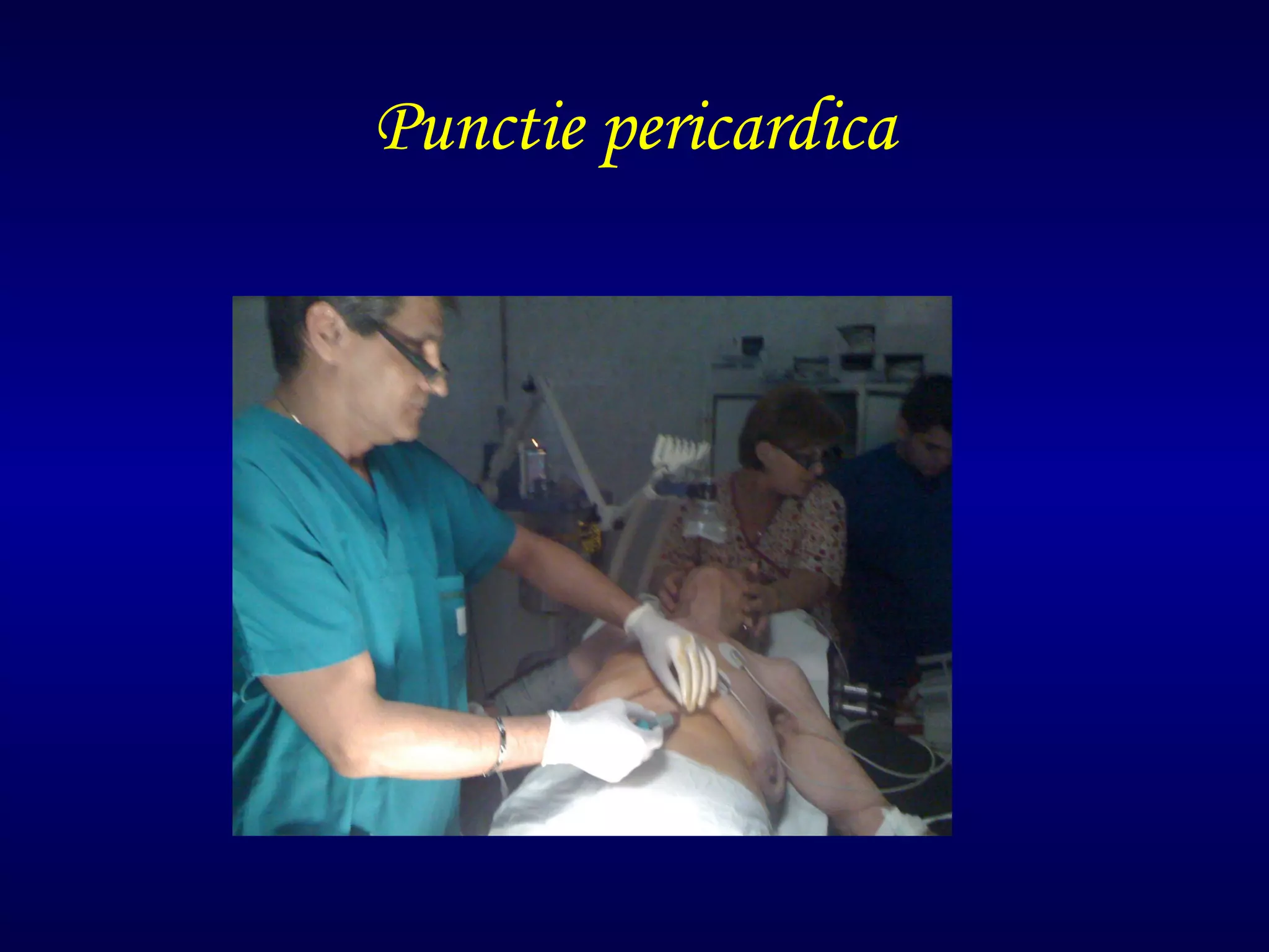 Drenajul pericardic percutan in pericardita neoplazica | PPT