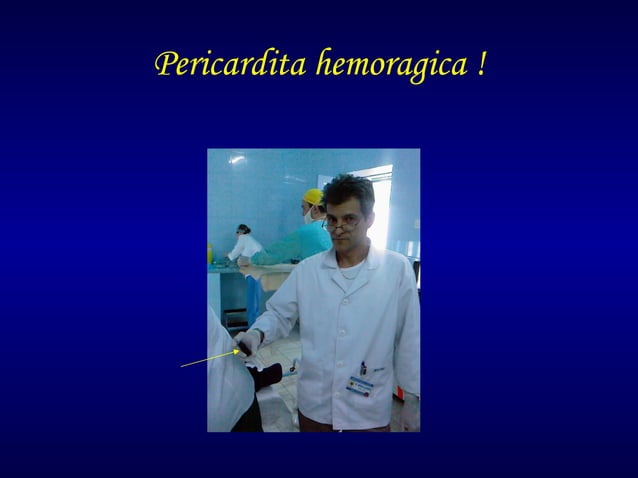 Drenajul pericardic percutan in pericardita neoplazica | PPT