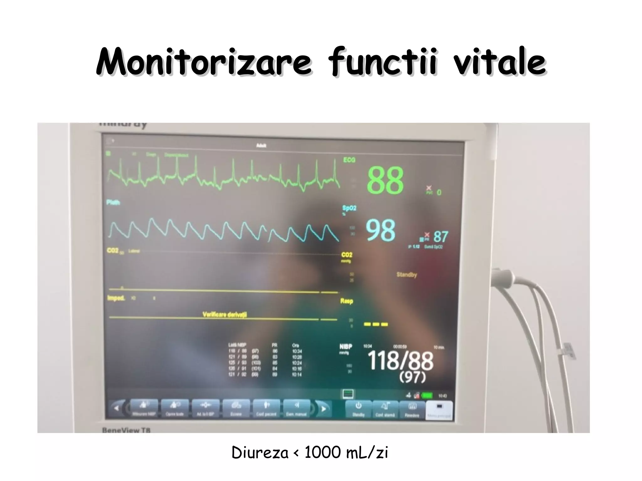 Drenajul peritoneal continuu ghidat ecografic | PPT