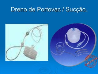 cuidados de enfermagem com drenos cirurgicos | PPT