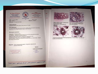 Dr eslam osama case | PPT