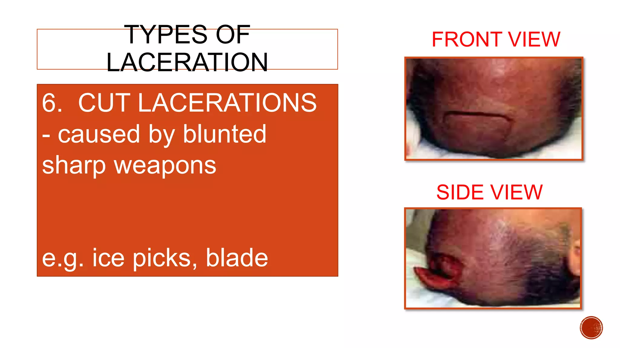 Dressing Surgical Wounds, Abrasion and Lacerations | PPTX