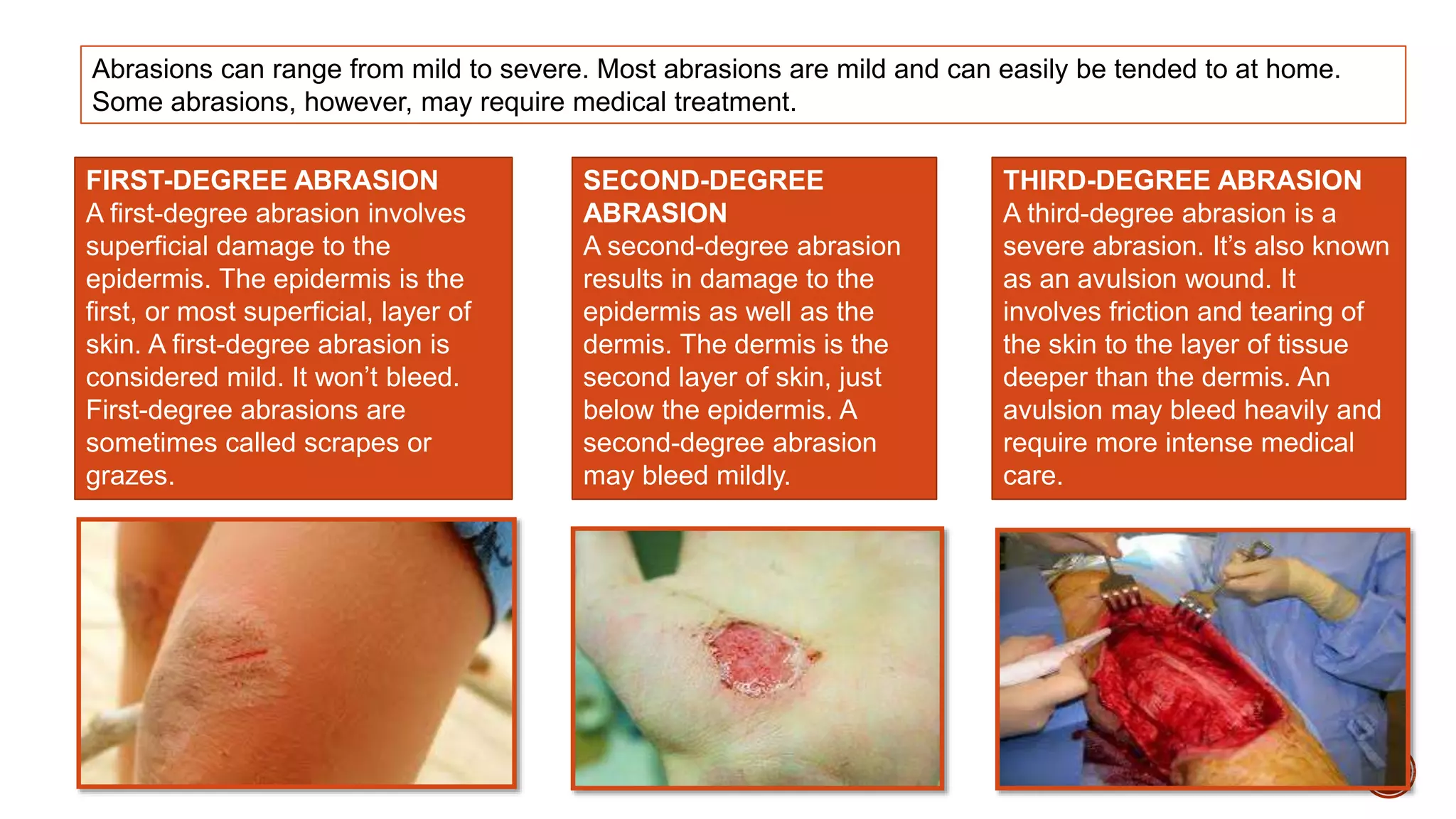 Dressing Surgical Wounds, Abrasion and Lacerations | PPTX