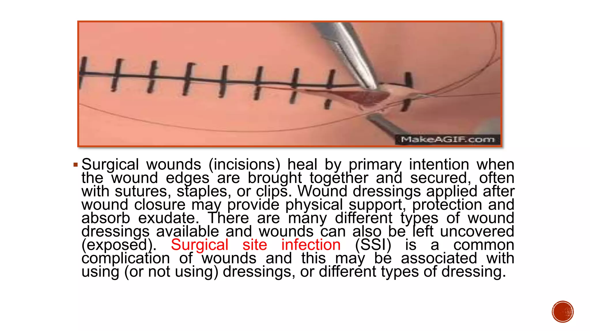 Dressing Surgical Wounds, Abrasion and Lacerations | PPTX