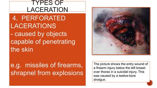 Dressing Surgical Wounds, Abrasion and Lacerations | PPTX | First Aid ...