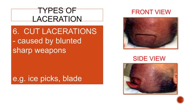 Dressing Surgical Wounds, Abrasion and Lacerations | PPTX | First Aid ...