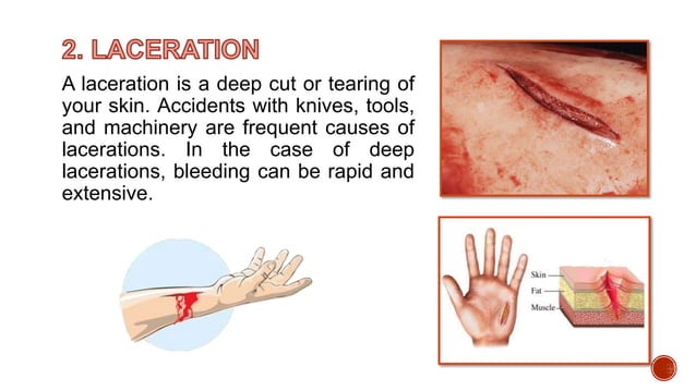 Dressing Surgical Wounds, Abrasion and Lacerations | PPT