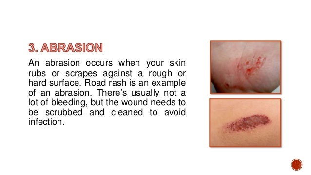 Dressing Surgical Wounds, Abrasion and Lacerations