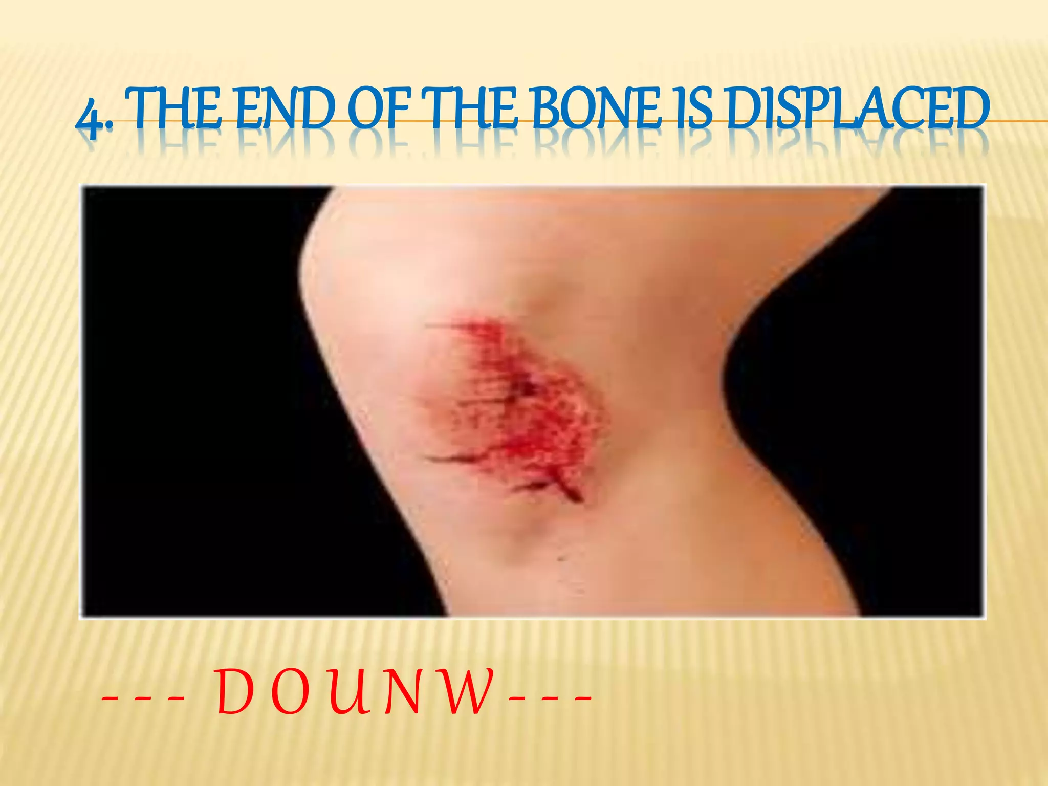 Dressing and bandages | PPTX