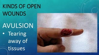 DRESSING AND BANDAGES.pptx | First Aid | Injuries