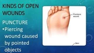 DRESSING AND BANDAGES.pptx | First Aid | Injuries