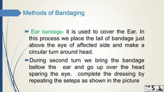 Dressing and bandaging (rollar) english | PPTX
