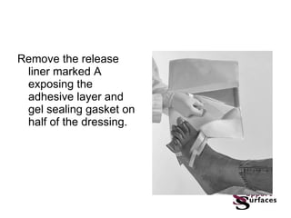 Dressing Application Guide Forefoot Dressing | PPT