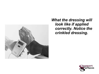 Dressing Application Guide Forefoot Dressing | PPT