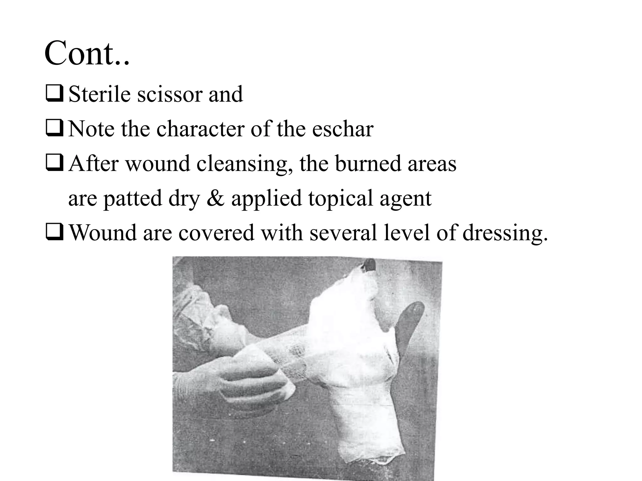 Dressing of burn wound | PPT
