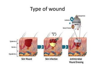 dressingprocedureppt-210910173151.pdf