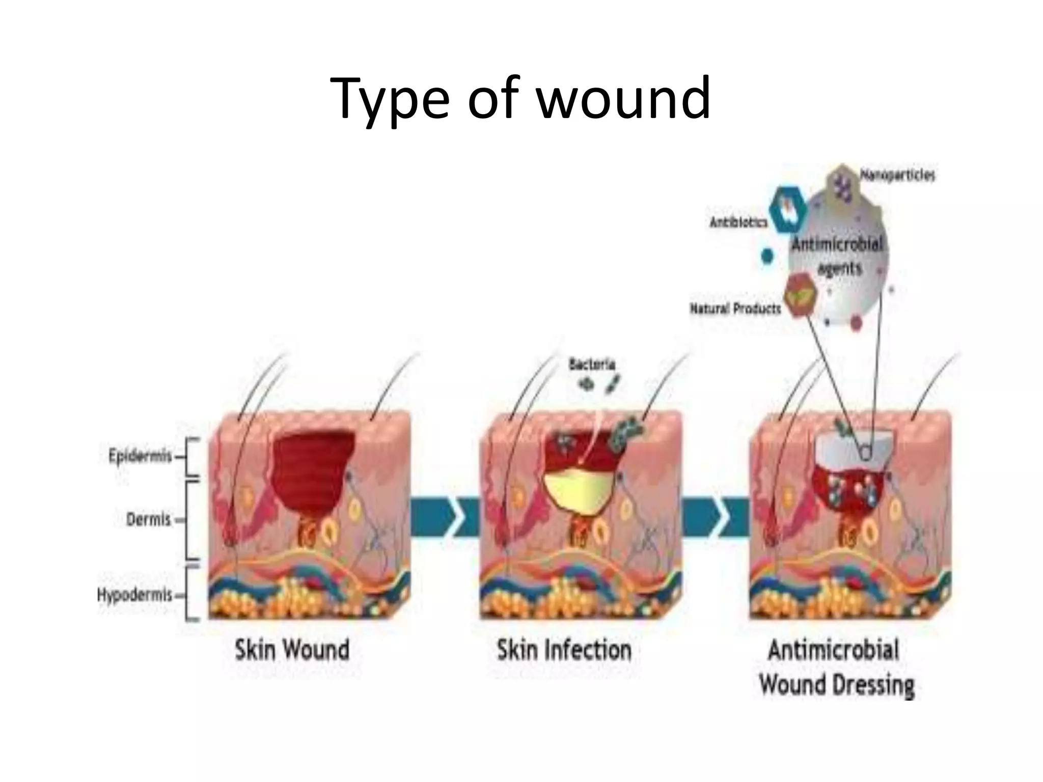 Dressing procedure ppt | PPTX