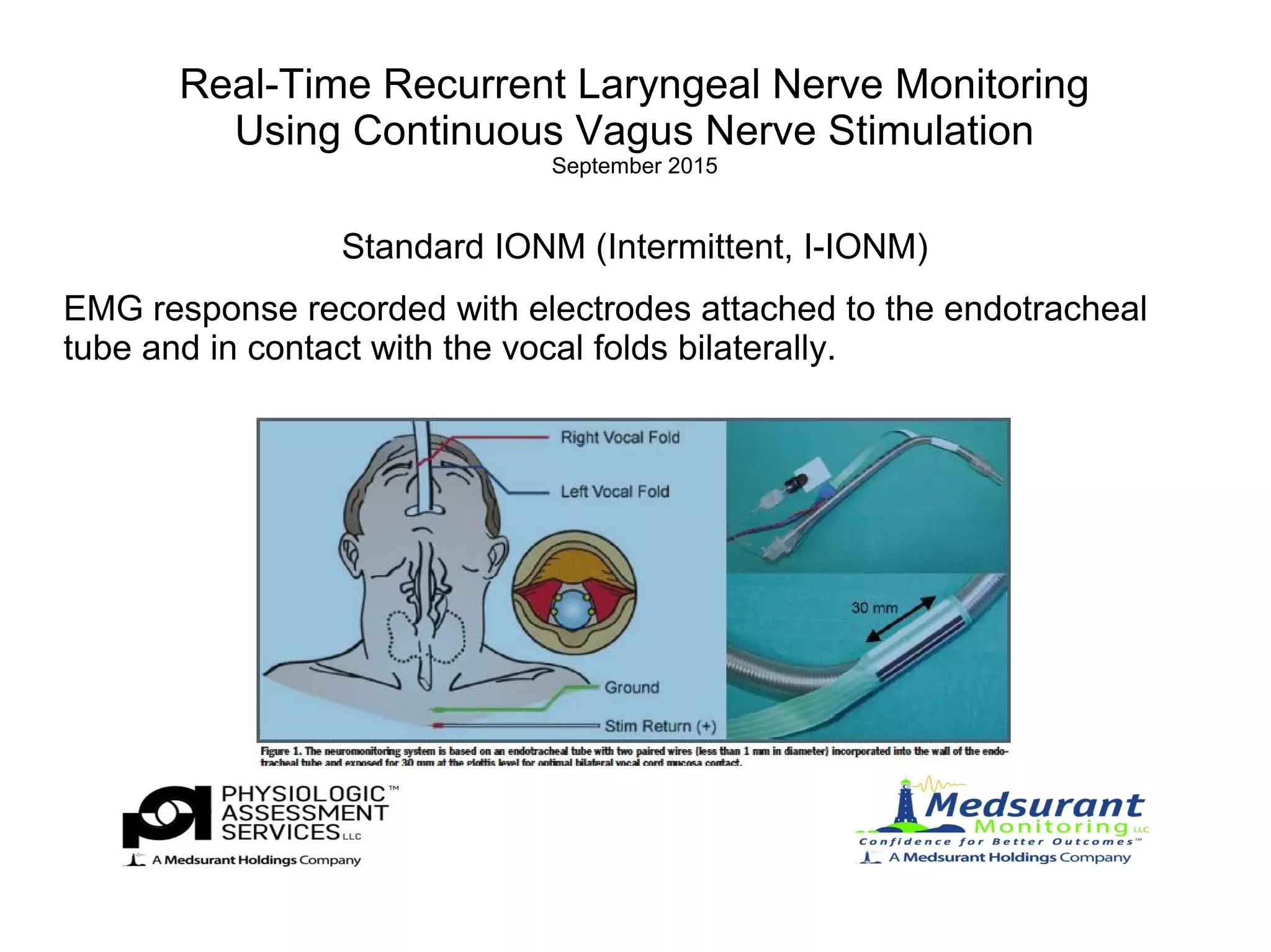Real-Time Recurrent Laryngeal Nerve Intraoperative Monitoring Using ...
