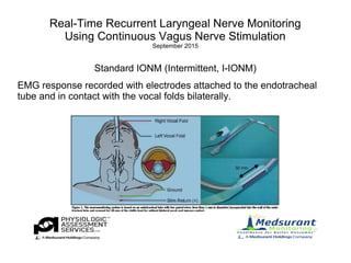 Real-Time Recurrent Laryngeal Nerve Intraoperative Monitoring Using ...
