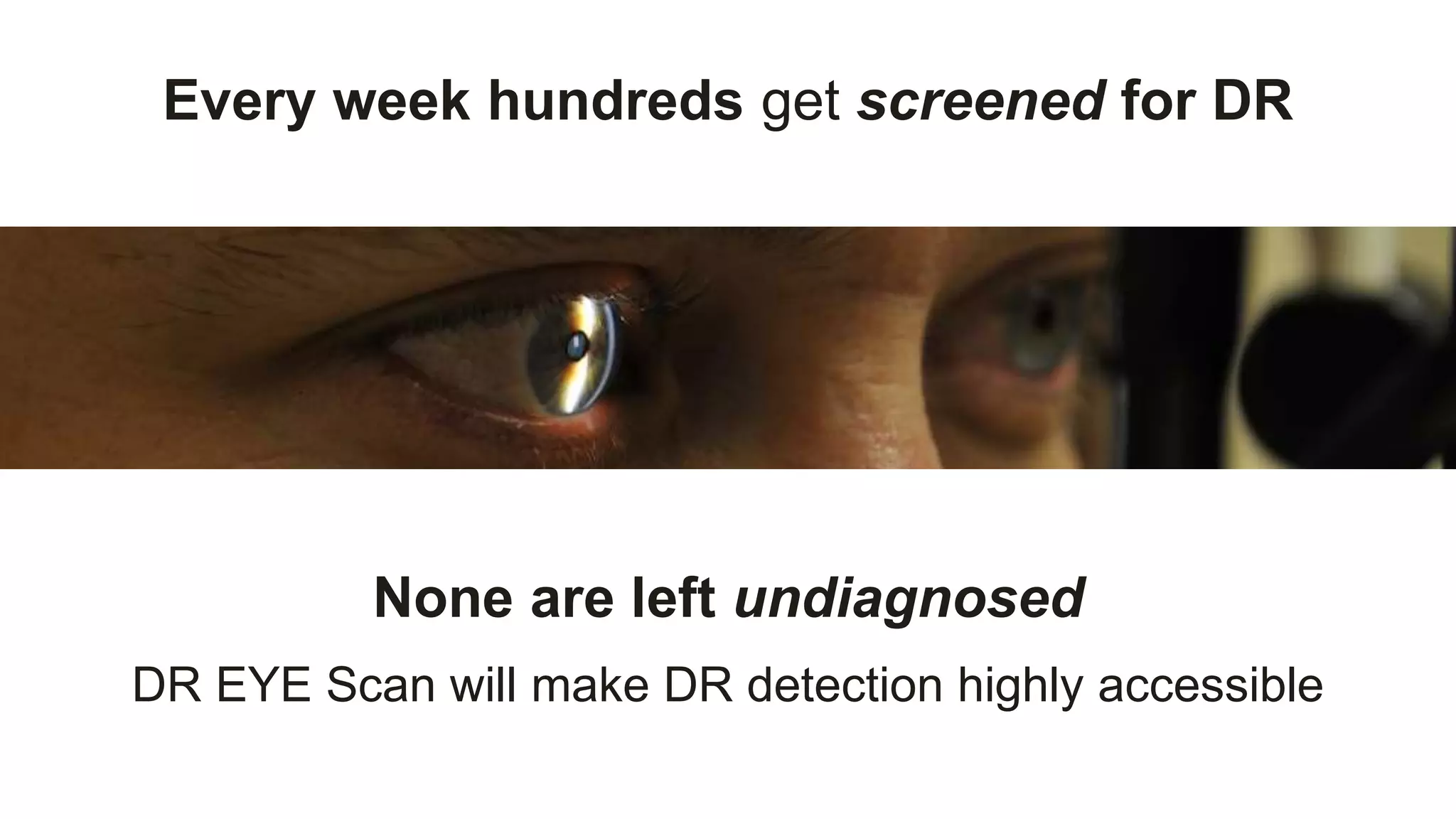 Diabetic Retinopathy Detection Using Cnn Image Classification Algorithm