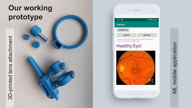 Diabetic Retinopathy Detection Using Cnn Image Classification Algorithm Ppt