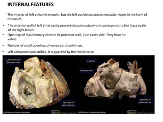 Dr Garva Ameta anatomy Of Left Heart.pptx