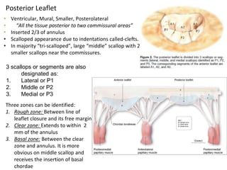 Dr Garva Ameta anatomy Of Left Heart.pptx