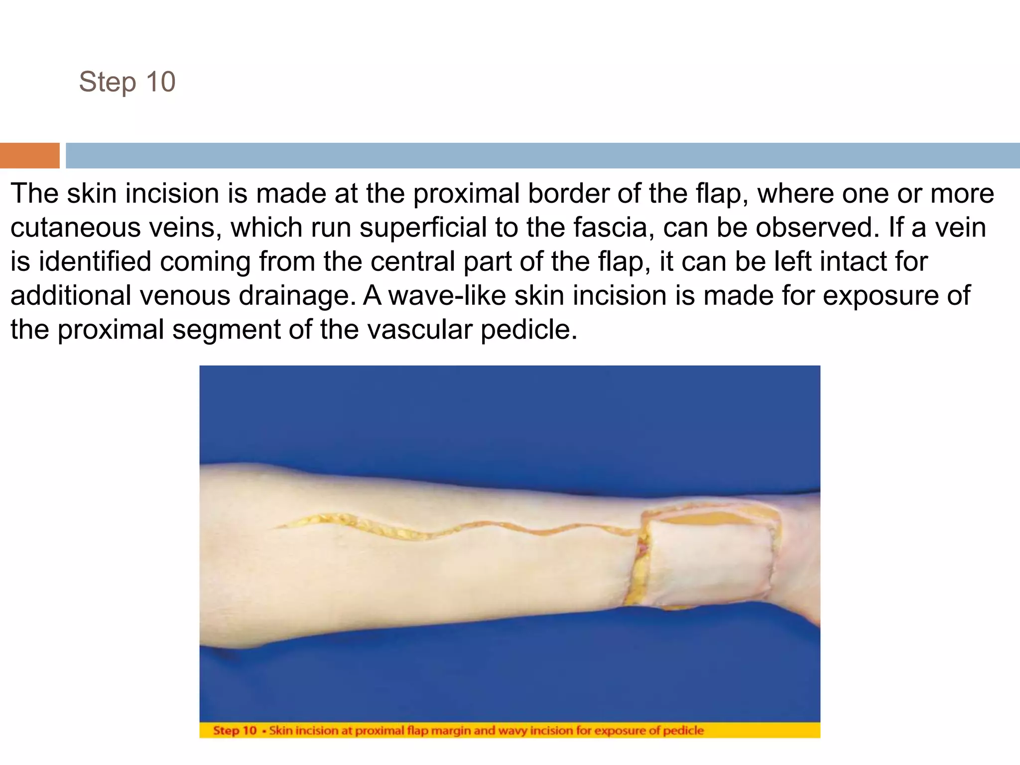Radial Forearm Flap | PPTX