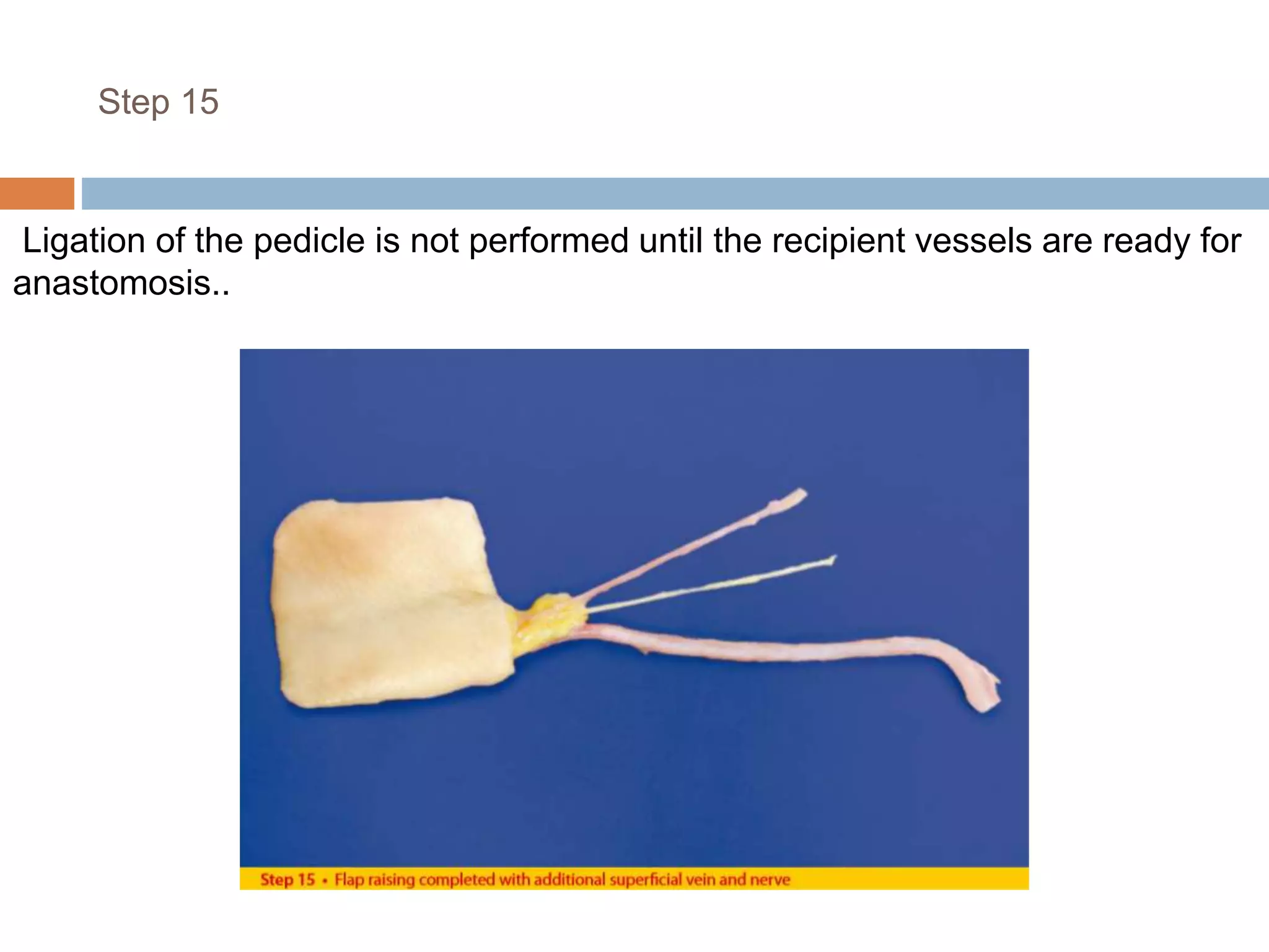 Radial Forearm Flap | PPTX