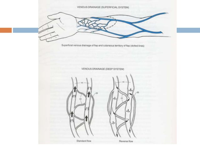Radial Forearm Flap | PPTX