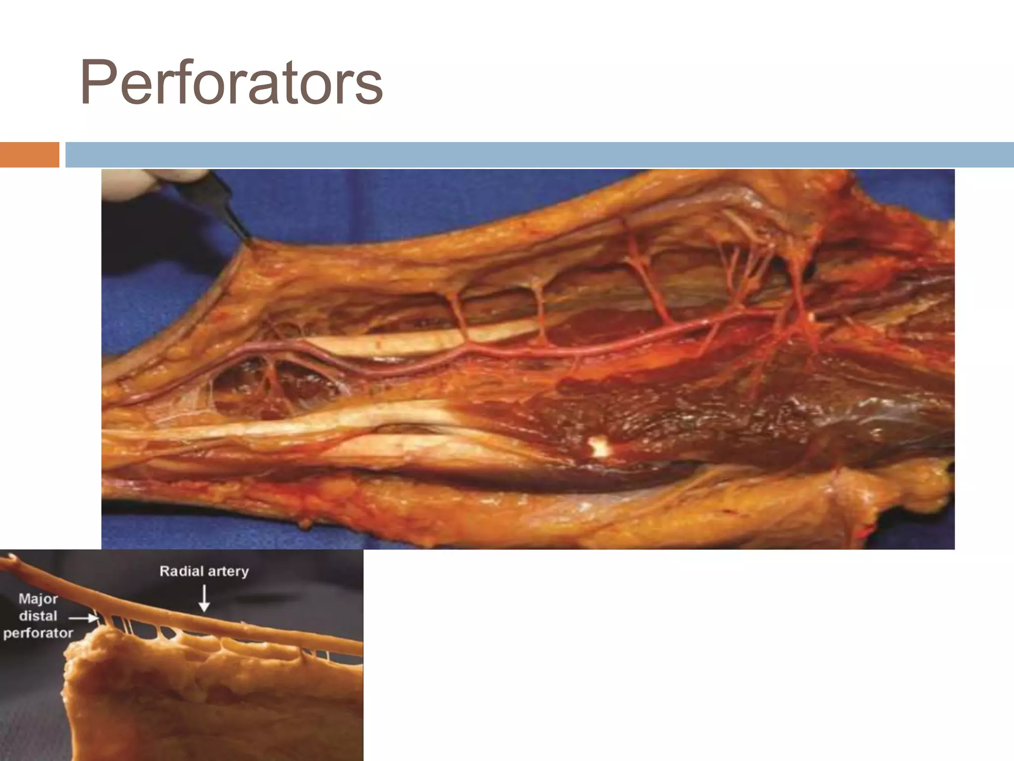 Radial Forearm Flap - Hand Surgery | PPTX