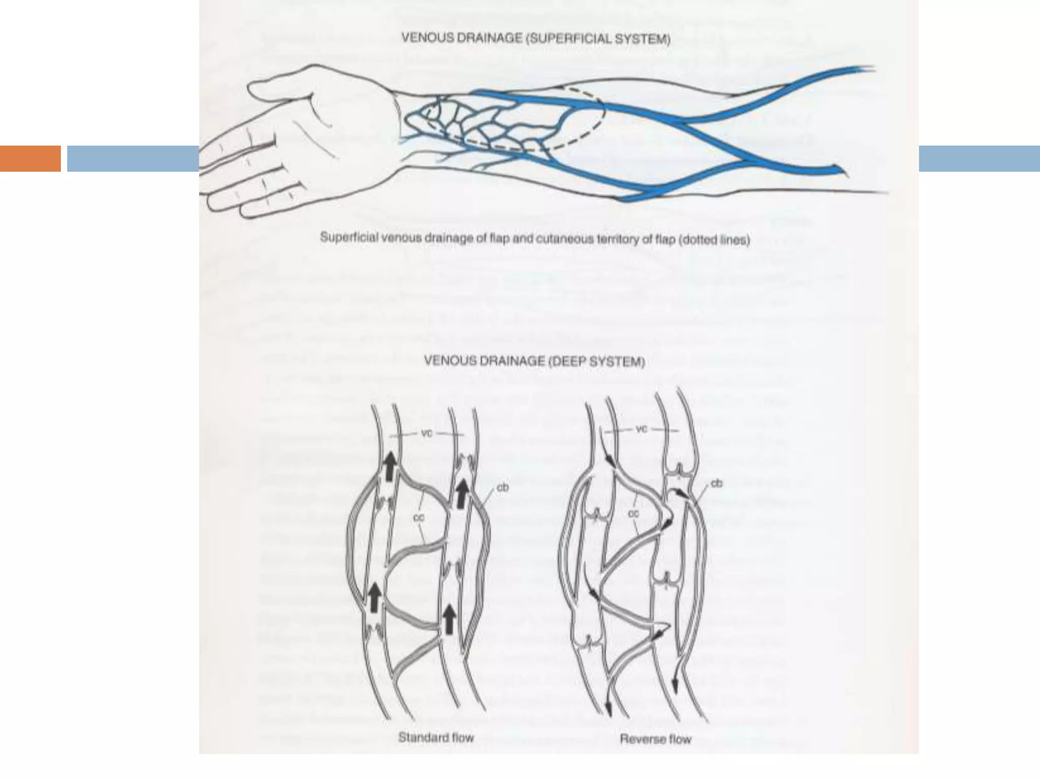 Radial Forearm Flap - Hand Surgery | PPTX