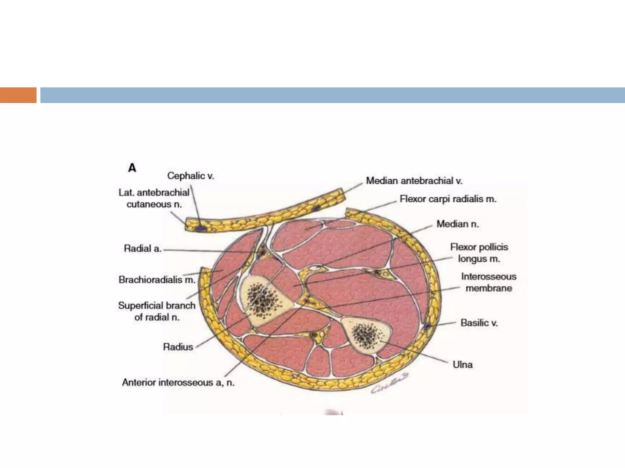 Radial Forearm Flap - Hand Surgery | PPTX