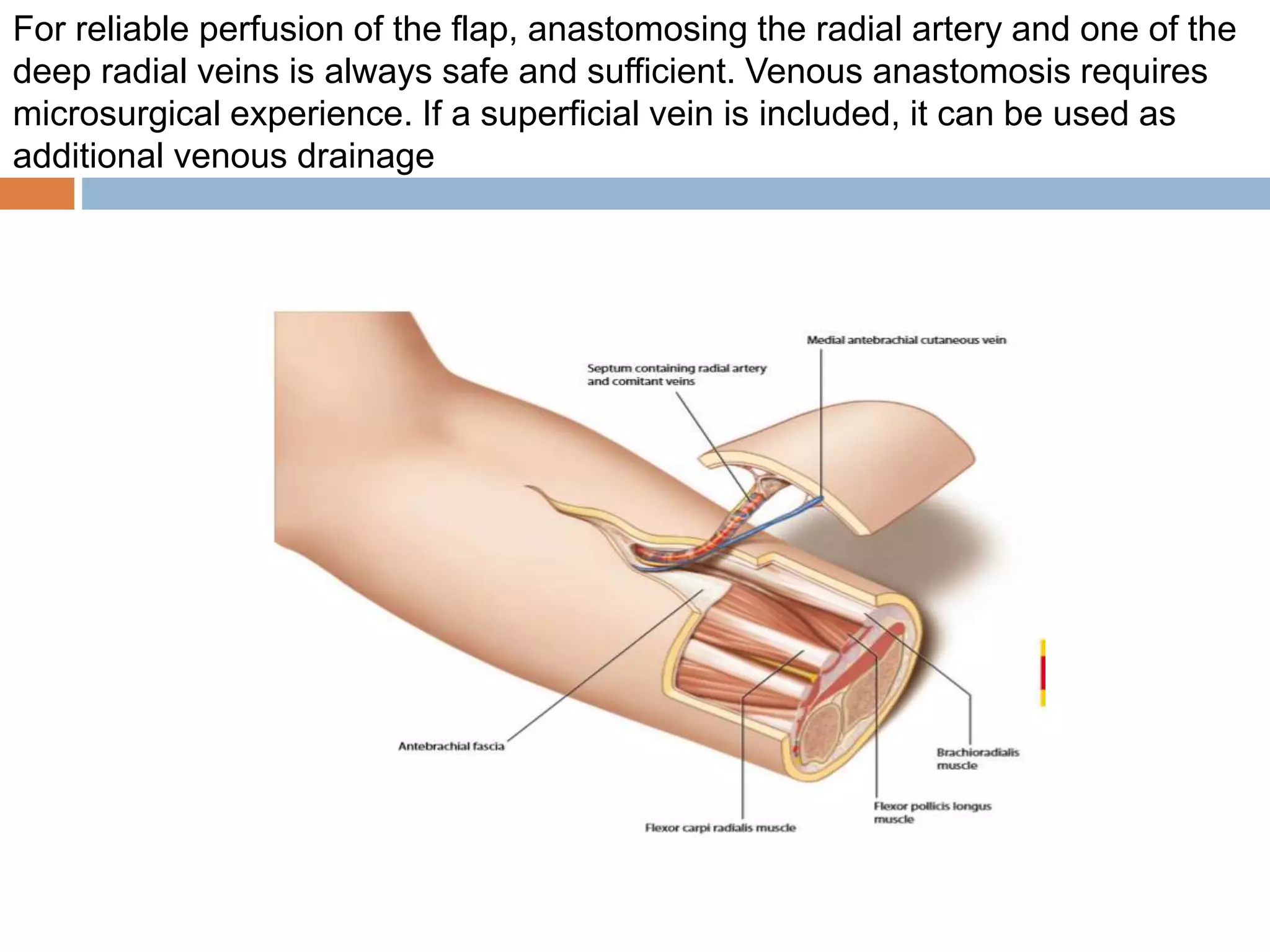 Radial Forearm Flap - Hand Surgery | PPTX