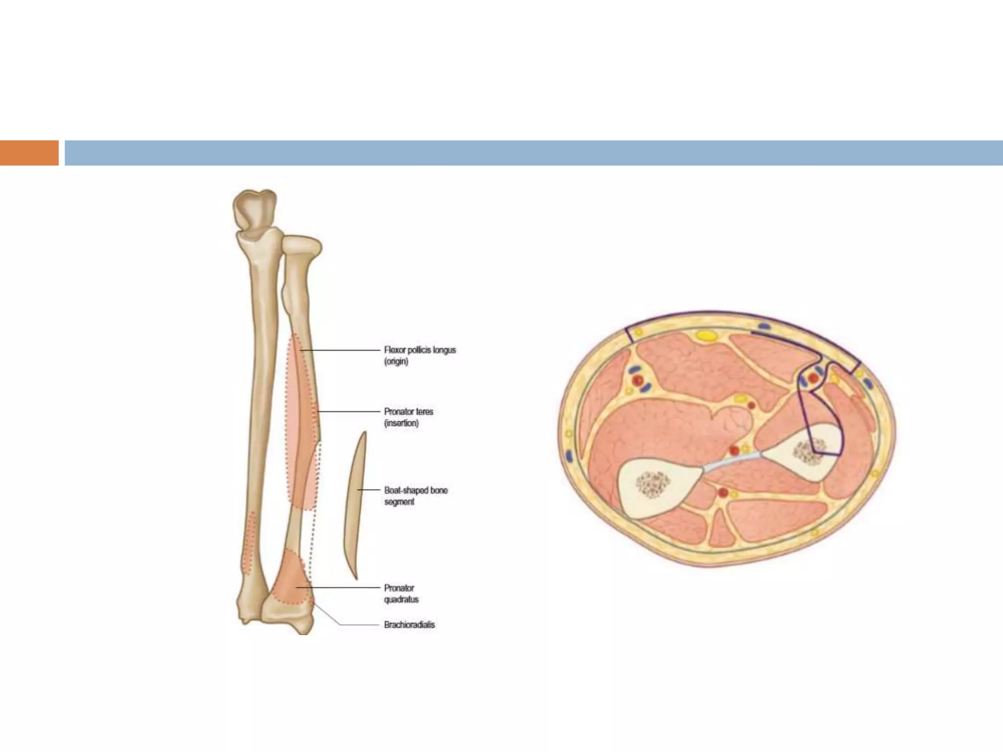 Radial Forearm Flap - Hand Surgery | PPTX