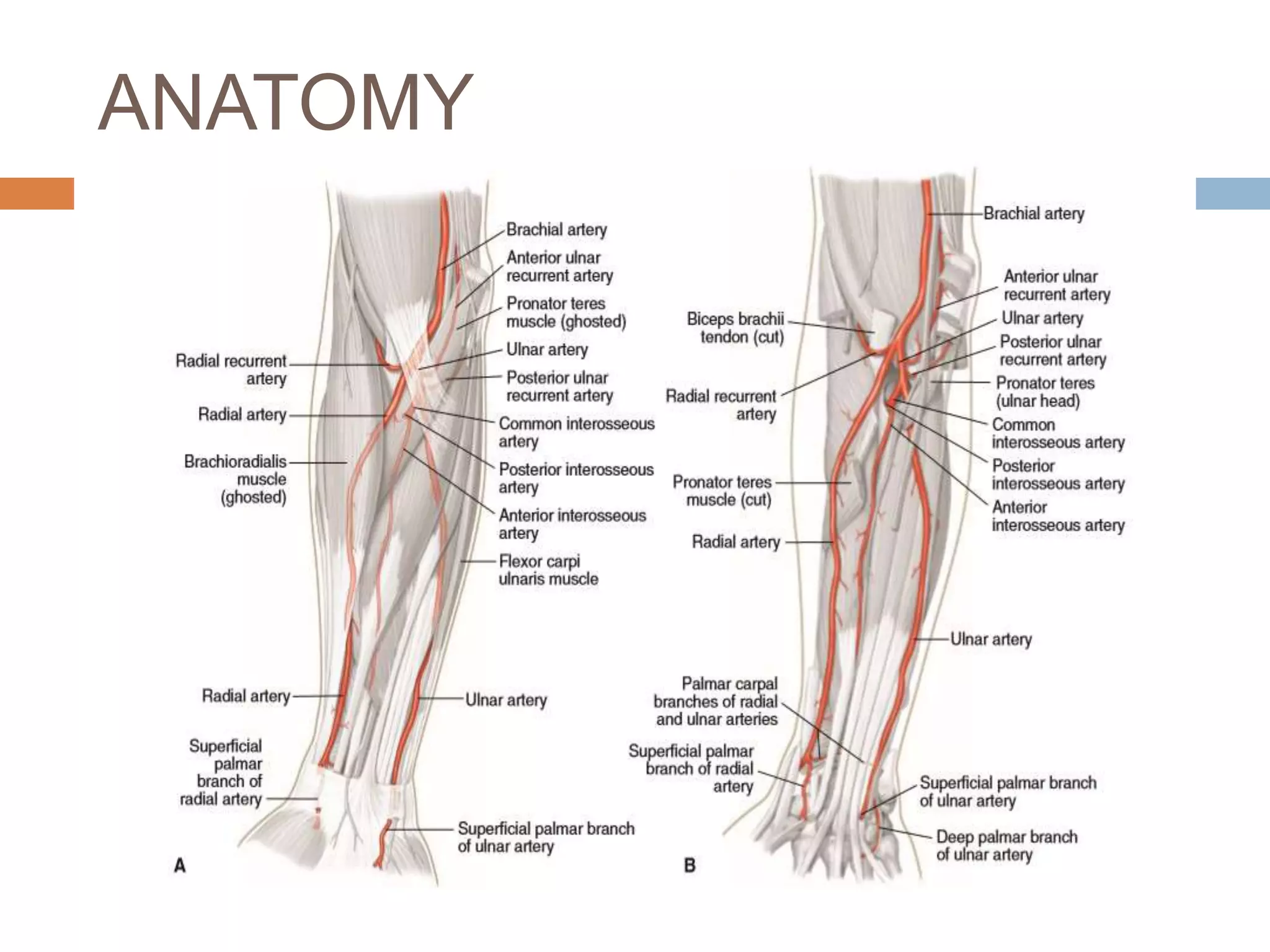 Radial Forearm Flap - Hand Surgery | PPTX