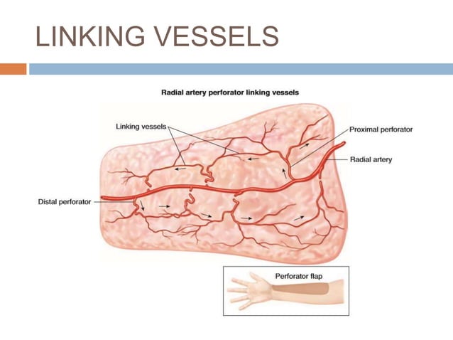 Radial Forearm Flap - Hand Surgery | PPTX