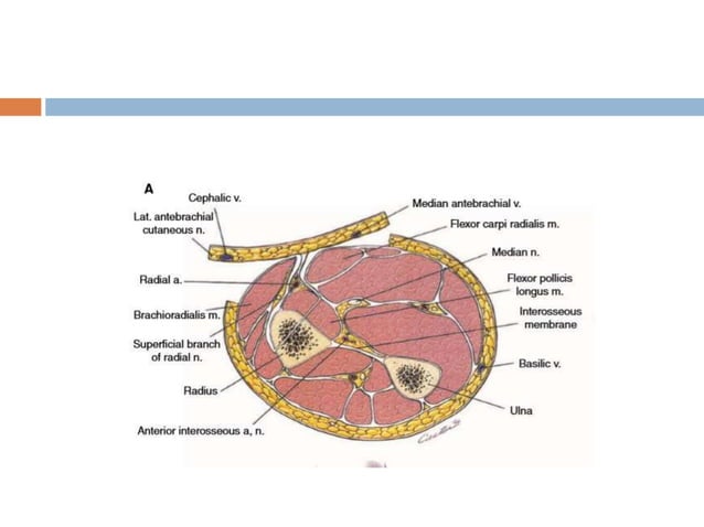 Radial Forearm Flap - Hand Surgery | PPTX
