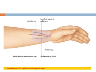 Radial Forearm Flap - Hand Surgery | PPTX