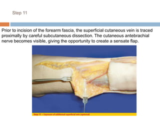 Radial Forearm Flap - Hand Surgery | PPTX